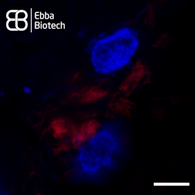 Amytracker for the study of tau aggregates – Ebba Biotech AB