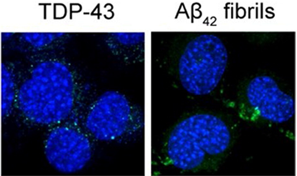 Amyloid formation in ALS: Redefining the role of TDP-43 inclusions ...