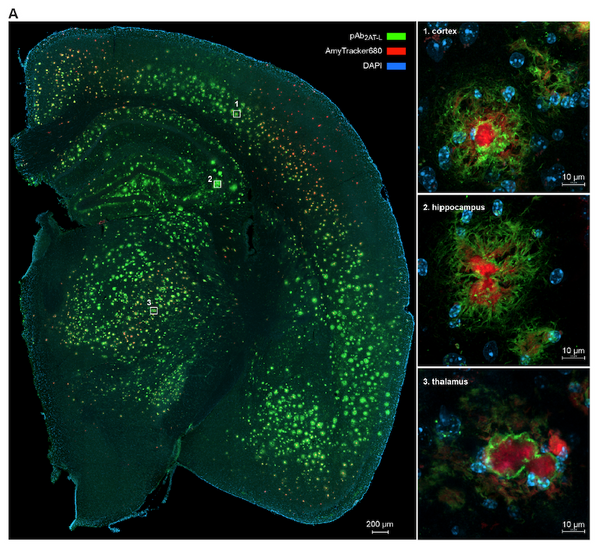 Amytracker 680 Publication – Ebba Biotech AB