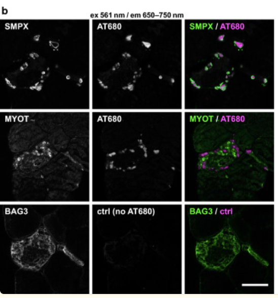 Amytracker confirms amyloid nature of inclusion bodies in muscle linke ...