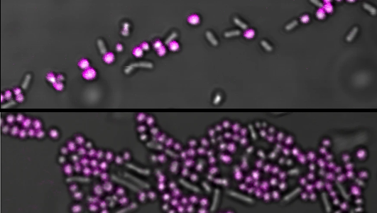 EbbaBiolight-like molecule for detection and quantification of bacteri ...