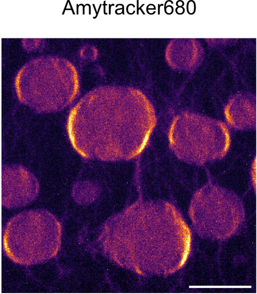 Transition to aggregation in hnRNPA1A condensates visualised using Amy ...