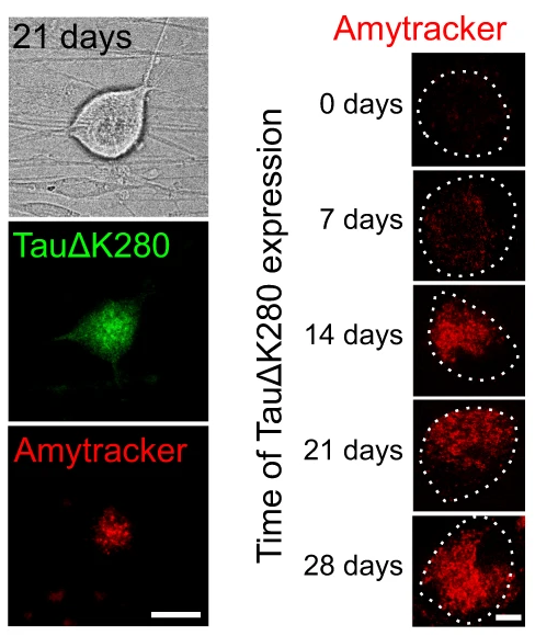 Amytracker labels amyloid forms of tau in a cell based model for tauop ...