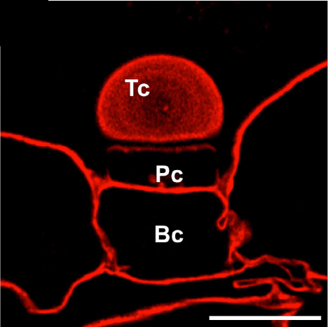 The Secrets of Utricularia: Nature’s Fastest Traps – Ebba Biotech AB