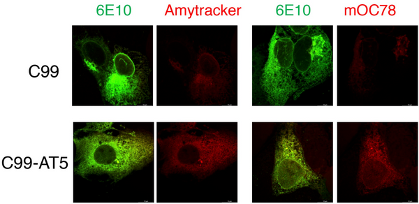 Faulty ribosome quality control triggers amyloid aggregation – Ebba ...