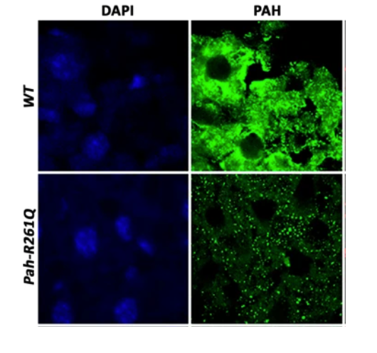 New Amytracker publication about protein aggregation in PKU – Ebba ...