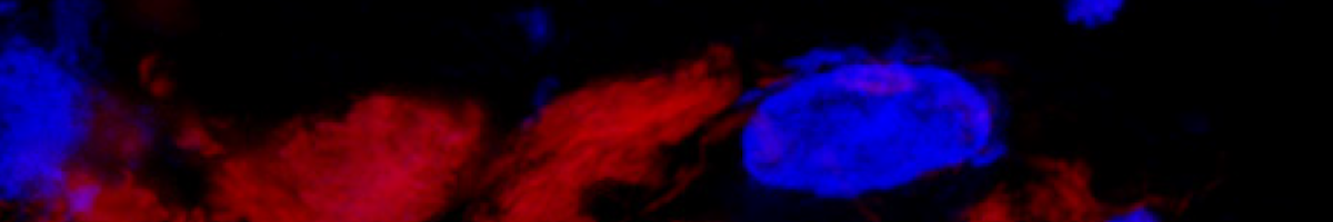 Amytracker – Ebba Biotech AB